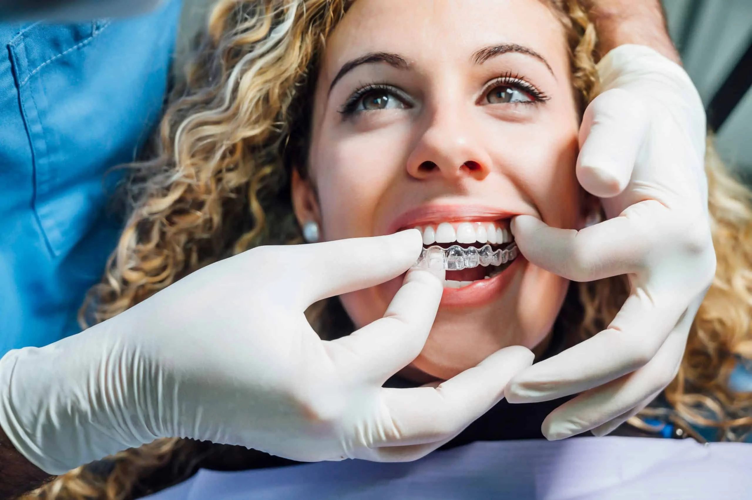 Dentist’s Ultimate Guide To Clear Aligner Attachments | Avant Dental