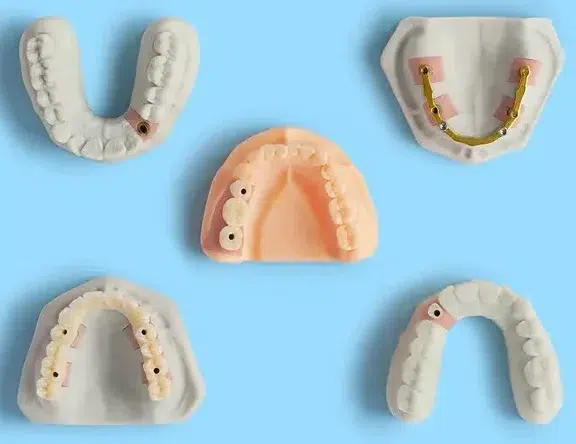 Dental Laboratory Brisbane | Avant Dental